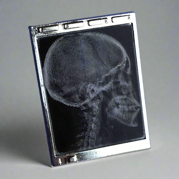 Lenticular Radiology Light Box Pin - Rad Girl Creations - Medical ...