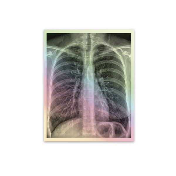 Holographic Xray Decal Pack - Rad Girl Creations - Medical Decal